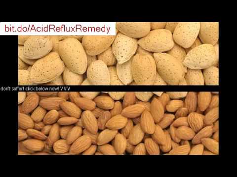 Heartburn Acid Reflux Disorder Animation Indicators, Triggers, Remedies ...